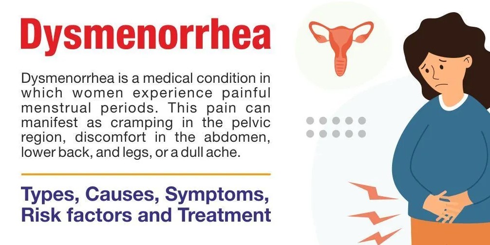 Irregular Menstrual Cycles - Healthooz